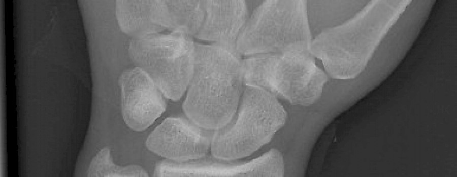 Basiswissen: Handwurzelknochen (Ossi carpi) - MTA-R.de